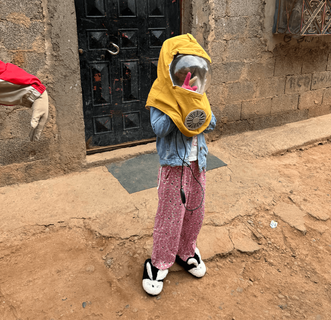 Xeroderma Pigmentosum : qu'est-ce que c'est ? - Ummah Charity